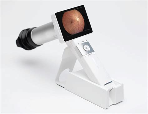 Ophthalmoscopy Vitreum Ophthalmology Clinic