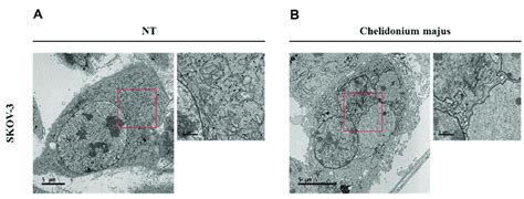 Morphological Ultrastructural Appearance Of Ovarian Cancer Cells After Download Scientific