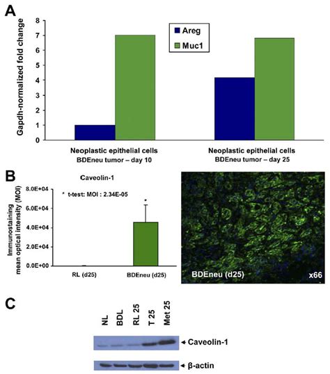 Intrahepatic Cholangiocarcinoma Progression Prognostic Factors And