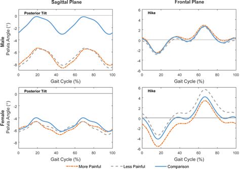 Gait Alterations In Femoroacetabular Impingement Syndrome Differ By Sex Pmc
