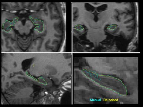 Shape Denoising