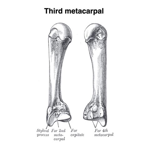 Metacarpal Bones Radiology Reference Article