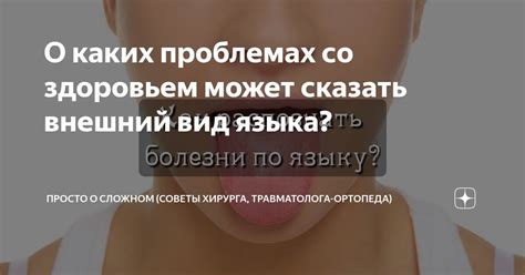 О каких проблемах со здоровьем может сказать внешний вид языка Просто о сложном советы