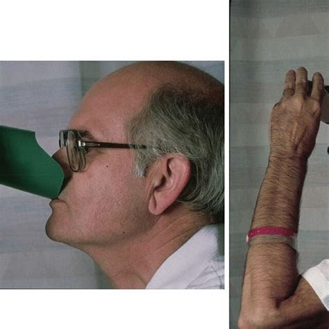 A Patient With Inclusion Body Myositis Ibm Participating In An