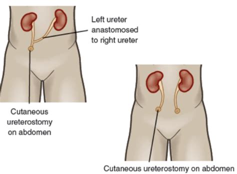 Fundamentals Module Flashcards Quizlet Fundamentals Module Flashcards Quizlet