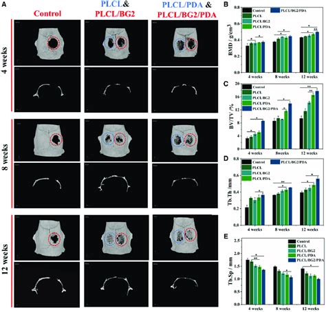Bone Regeneration In A Rat Calvarial Bone Defect Model A Typical 3d