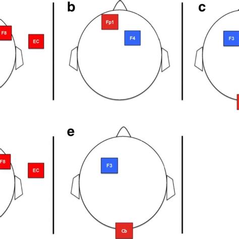 Pdf The Impact Of Transcranial Direct Current Stimulation Tdcs On