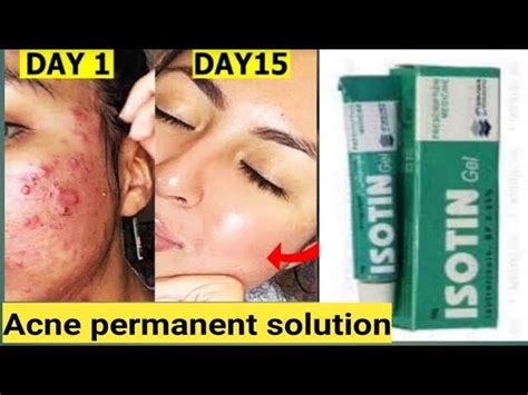 Isotin Gel 10gm Darazpk Buy Online At Best Prices In Pakistan