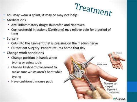Ppt Carpal Tunnel Syndrome Powerpoint Presentation Free Download Id 2822201