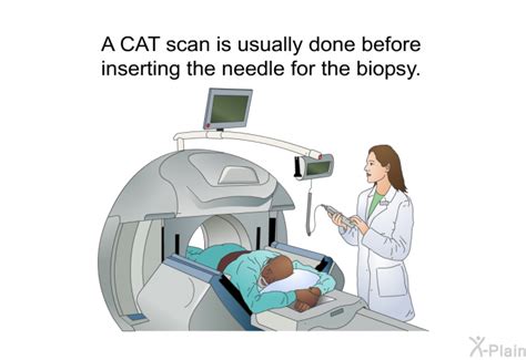 Cat Scan Guided Biopsy Of A Spinal Lesion