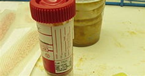 Pemeriksaan Makroskopis Feses