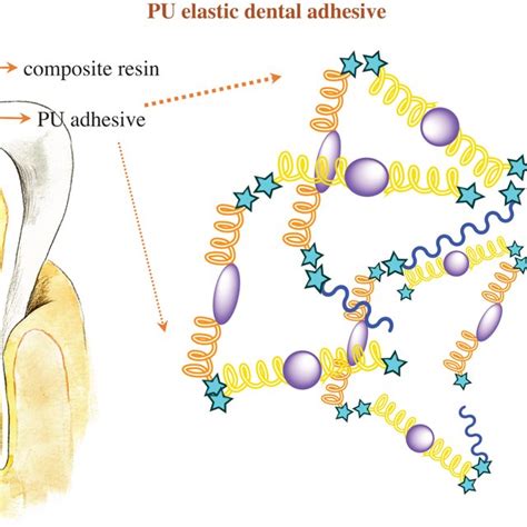 Schematic Model For Elastic Pu Adhesive Using For Tooth Dentine Bonding