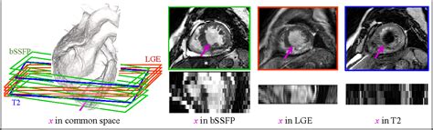Figure 1 From Multivariate Mixture Model For Myocardial Segmentation Combining Multi Source