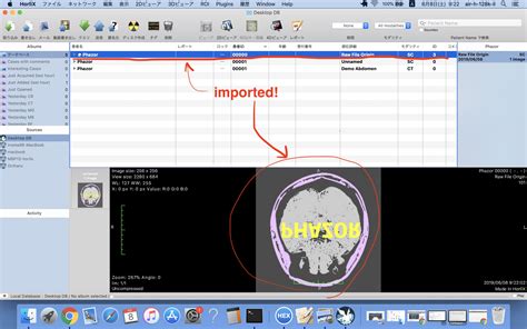 Dicom Results Segmentation Any Viewer Available Google Groups Archive Orthanc Users