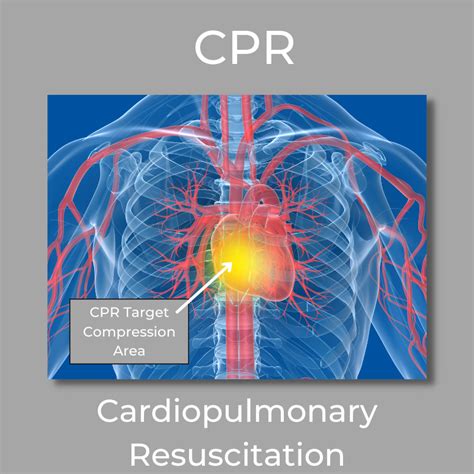 What Is Cardiopulmonary Resuscitation
