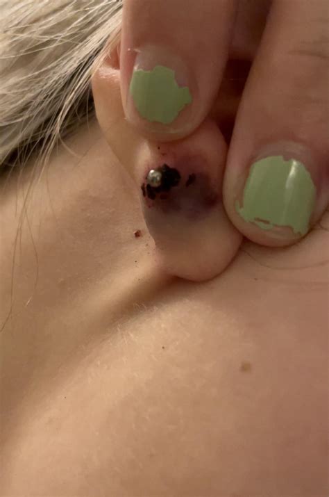 Why Is Ear Piercing Bleeding After Years Nose And Earrings