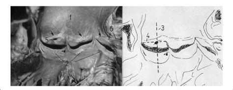 The Aorta 1 Opened To Show The Aortic Valve 2 The Sinotubular Download Scientific Diagram