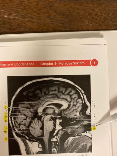 Lab 7 Human Brain Anatomy Flashcards Quizlet