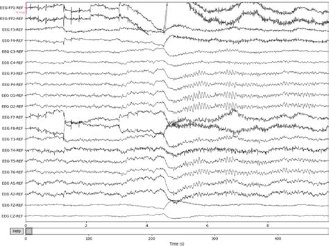 Post Cropping And Resampling Visualization Of The Eeg Recordings
