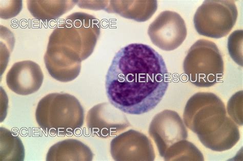 Lymphocytes Under Microscope Description
