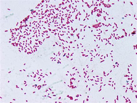 Gram Negative Rods Types Of Bacteria At Martin Delaney Blog