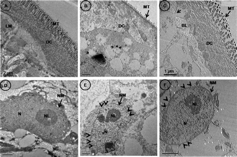 Transmission Electron Micrographs Of Control A D A Maximum