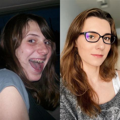 20 Ugly Ducklings Who Had A Glow Up Wow Gallery EBaum S World