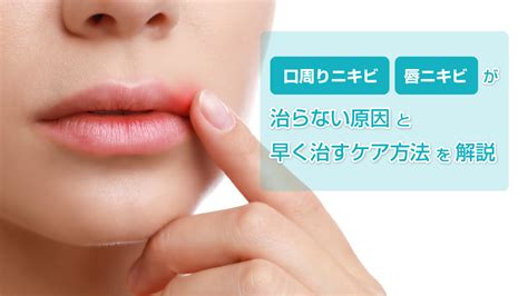口 の 中 の 上 かゆい 上顎 かゆい 舌でかく 「アレルギー性鼻炎」の対処法 Itzc 口 の 中 の 上 かゆい 上顎 かゆい 舌でかく 「アレルギー性鼻炎」の対処法 Itzc