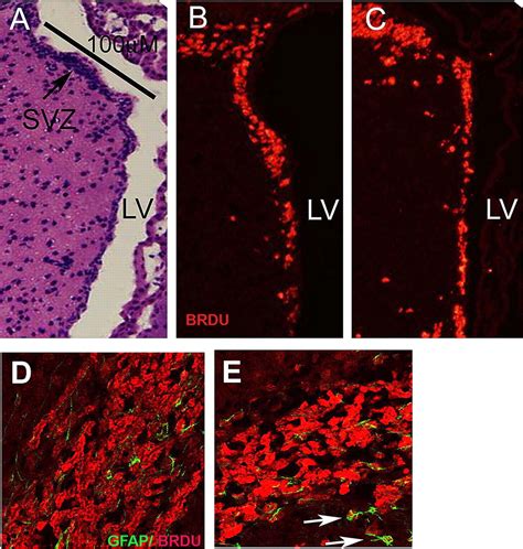 Id2 Is Required For Specification Of Dopaminergic Neurons During Adult Olfactory Neurogenesis