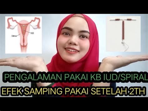 Pengalaman Pakai KB Spiral / IUD - YouTube