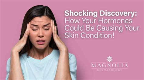 Hormone Driven Skin Conditions The Truth Revealed Magnolia Dermatology