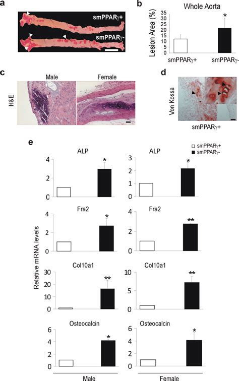 Figure S1 Vascular Calcification In Male And Female Mice A Opened Download Scientific