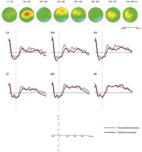 Grand Average Waveforms Time Locked To The Onset Of The Demonstrative