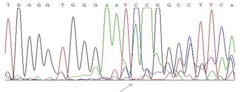 Sequence Analysis Of Abnormal Bands Corresponding To Exon Segment Download Scientific Diagram
