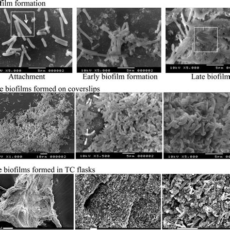 a schematic and sem visualisation of biofilm formation of c difficile