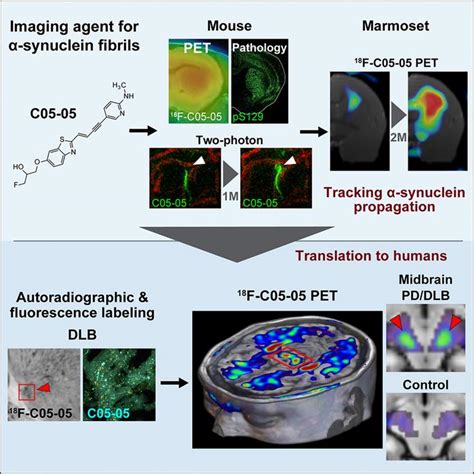 Visualizing Core Pathologies Of Parkinsons D Eurekalert