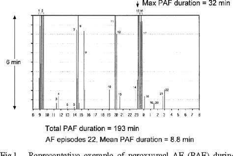 Figure 1 From Monitoring The Progression Of The Atrial Electrical Remodeling In Patients With