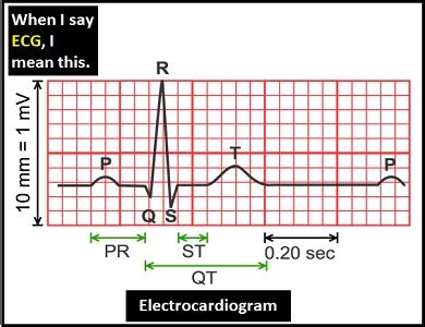 ecg what does ecg mean