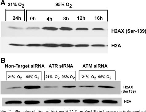 Figure 7 From Differential Roles Of Atr And Atm In P53 Chk1 And Histone H2ax Phosphorylation