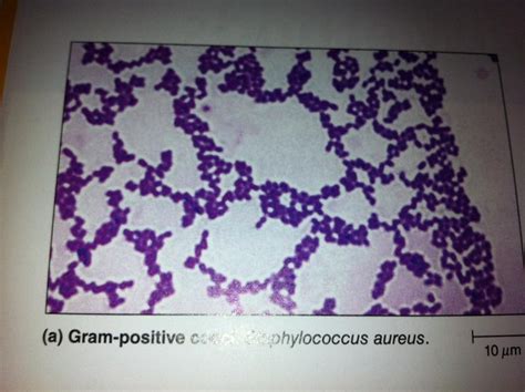 Simple Stain Staphylococcus Aureus Simple Stain Staphylococcus Aureus
