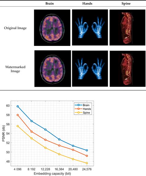 Table 3 From A Reversible Watermarking System For Medical Color Images