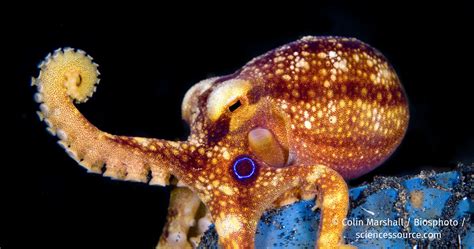 Science Source Images Human X And Y Chromosomes Scanning Electron Microscope Image Of Human X