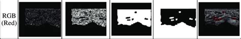 Example Of Edge Detection A Applying A Binary Gradient Mask B