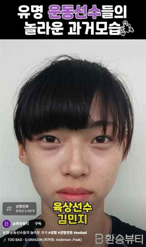 카리나 닮은꼴 육상선수 김민지 성형 전 후  인스티즈