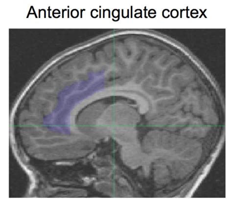 Ventromedial Prefrontal Cortex