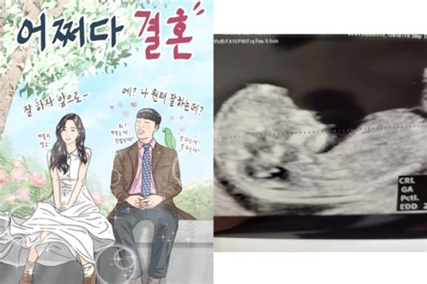 장윤석 혼전임신→오늘 4일 미모의 치기공사 예비신부와 결혼[종합]