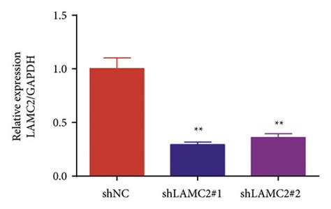 Lamc2 Was Highly Expressed In Lscc Cells A And B Lamc2 Mrna And