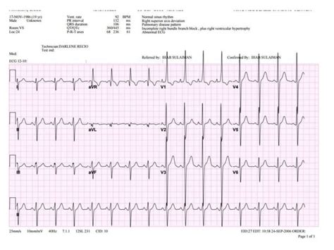 Cxr Findings In Cardiology Pptx Heart And Cardiovascular Diseases Diseases And Conditions