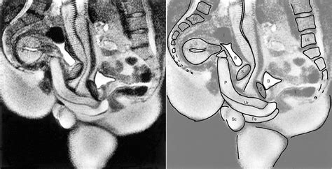 A Cross Sectional Diagram Of The Sex Act In Porn Porn