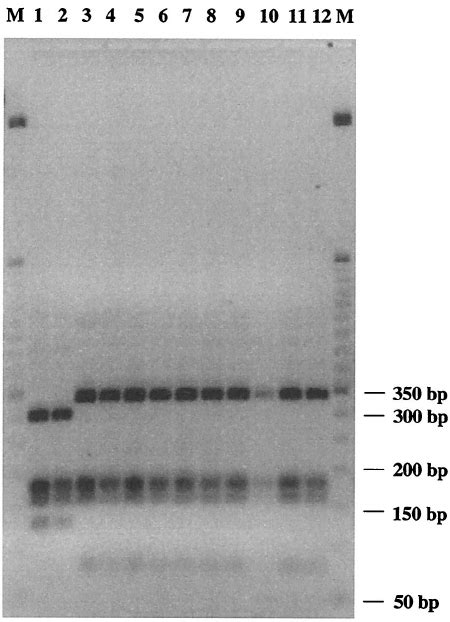 Restriction Patterns Of Pcr Ampli Fi Ed Fragments Of 16s 23s Rdna